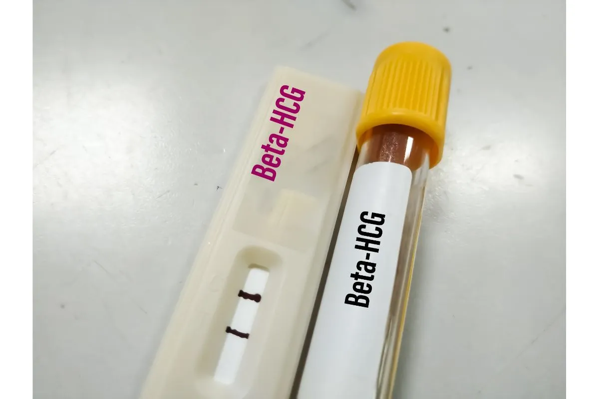 Beta HCG Nedir? Beta HCG kaç olursa hamiledir, kaç olmalı? Beta HCG kaç ...